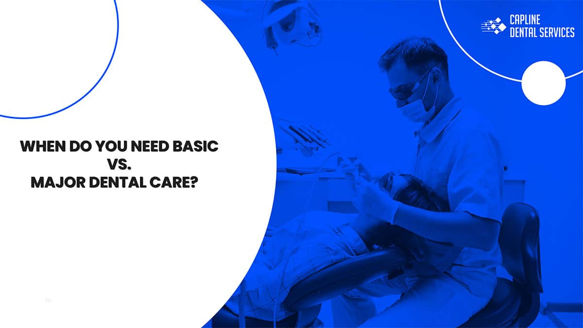 When Do You Need Basic Vs. Major Dental Care? - Capline Dental Services