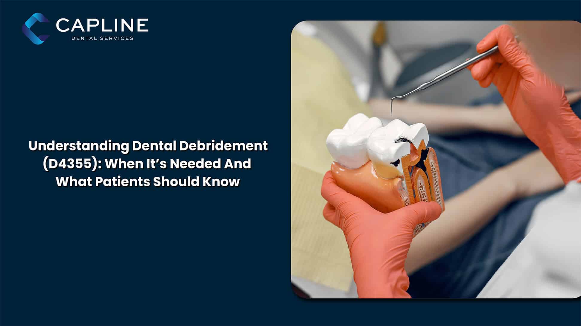 Understanding Dental Debridement (D4355): When It’s Needed And What Patients Should Know